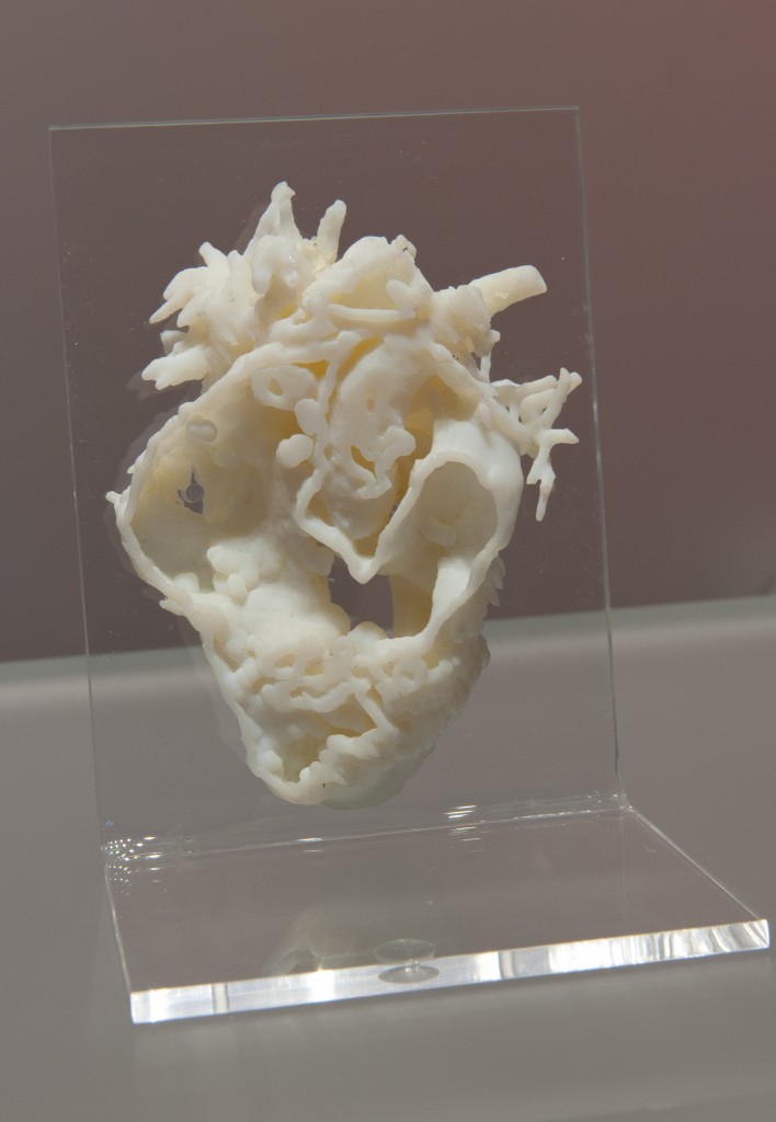 How to mend a broken heart - Science Museum Blog