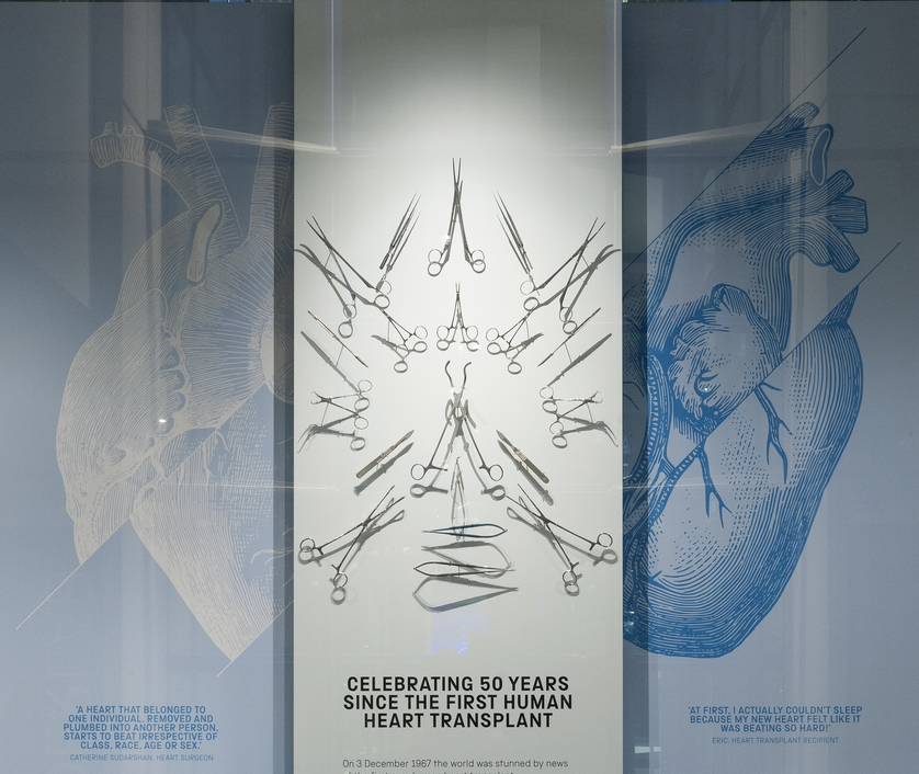 Fifty years of human heart transplants - Science Museum Blog