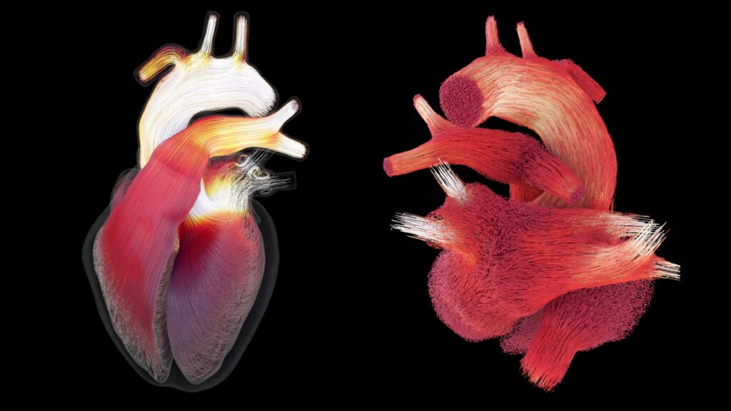 Virtual Heart: A new simulation revealed - Science Museum Blog